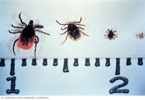 Lyme disease - Symptoms and causes - Mayo Clinic