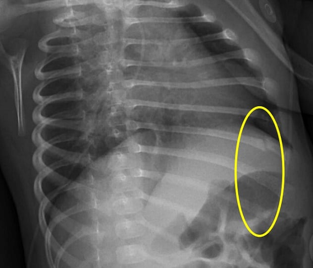 Eight tips for detecting and managing child abuse - Mayo Clinic