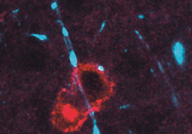 Laboratory study sheds light on pathogenesis of MS progression - Mayo ...