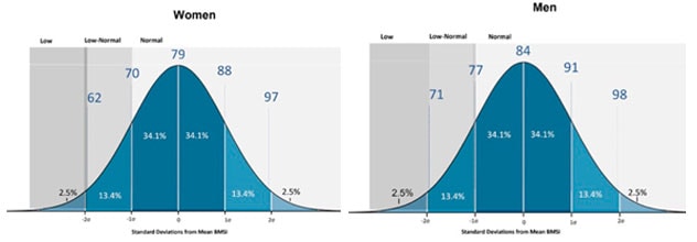 Mayo Clinic's innovative solutions for bone health assessment - Mayo Clinic