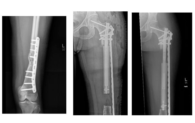 Mayo Clinic in Florida opens clinic, innovates in limb deformity and ...