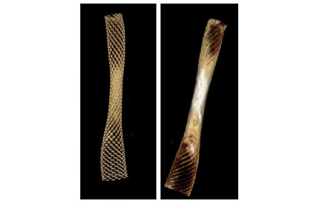 'Revolution' in CT enhances neurological care - Mayo Clinic