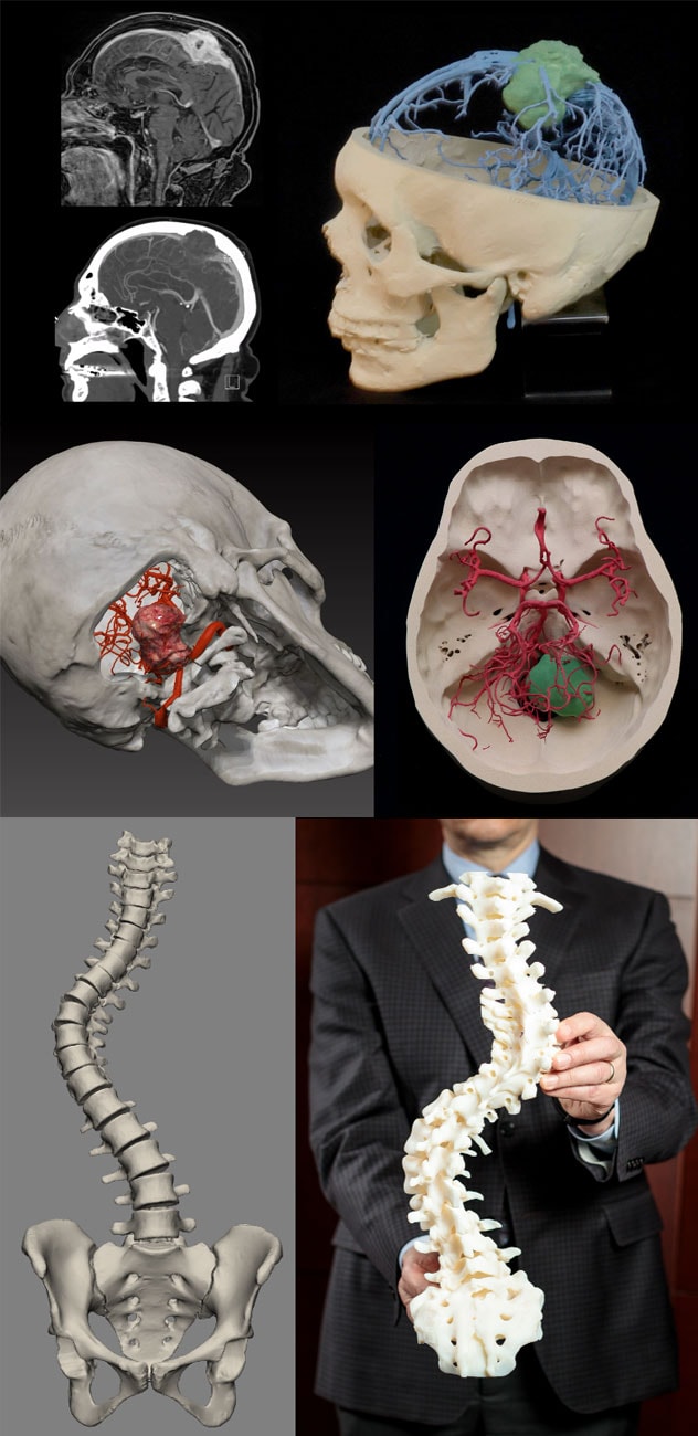 'Digital twins': 3D models enhance neurosurgical care - Mayo Clinic