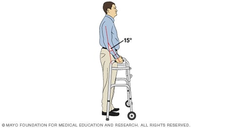 Slide show: Tips for choosing and using walkers - Mayo Clinic