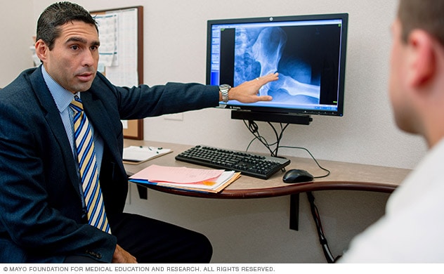 Hip dysplasia - Care at Mayo Clinic - Mayo Clinic