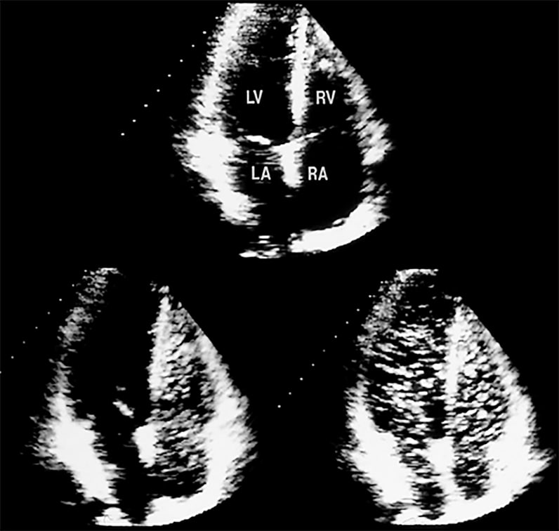 Pulmonary vascular complications of chronic liver disease - For Medical ...