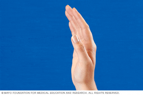 Hand exercises for people with arthritis - Mayo Clinic