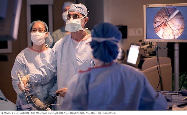 Donor nephrectomy - Mayo Clinic