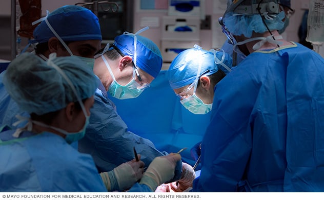 Wilms' tumor - Care at Mayo Clinic - Mayo Clinic