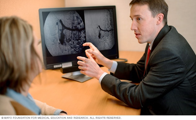 Spinal arteriovenous malformation (AVM) - Diagnosis and treatment ...