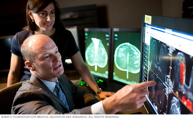 Breast cancer surgery - Care at Mayo Clinic - Mayo Clinic