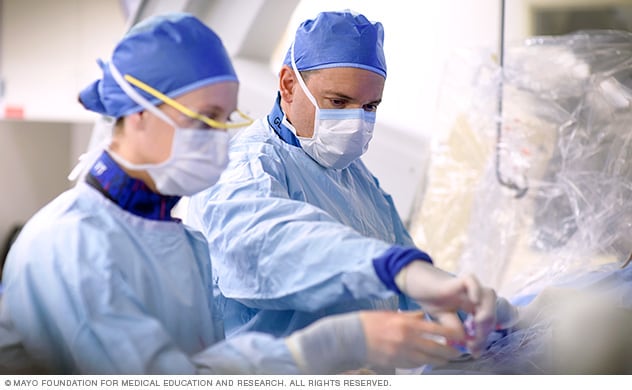 Carotid angioplasty and stenting - Care at Mayo Clinic - Mayo Clinic