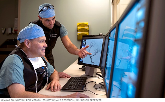 Dural arteriovenous fistulas - Diagnosis and treatment - Mayo Clinic