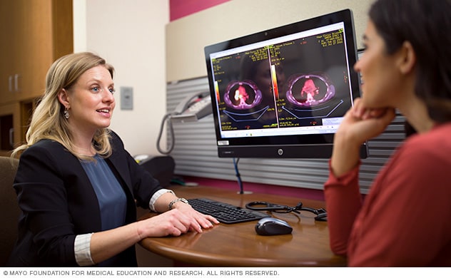 Non-Hodgkin lymphoma - Care at Mayo Clinic - Mayo Clinic