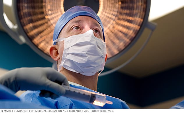 Vesicoureteral reflux - Care at Mayo Clinic - Mayo Clinic