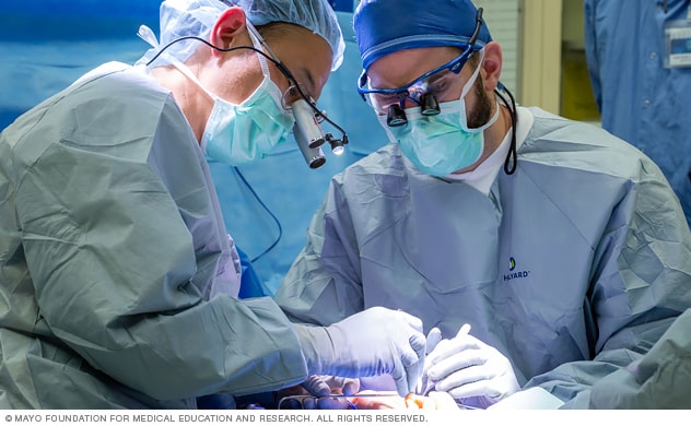 Upper Limb Reconstruction in Upper Motor Neuron Syndrome Clinic ...