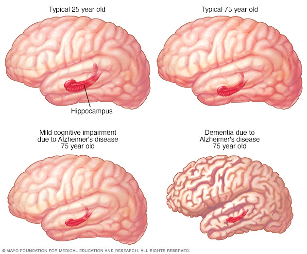 Brain Memory Center