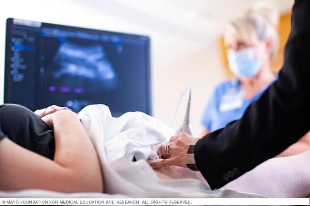 Biotherapeutics and Advanced Procedures Clinic - Overview - Mayo Clinic