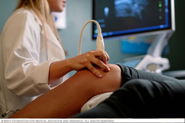 Ultrasound-Guided Injection Clinic - Overview - Mayo Clinic